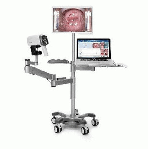 Edan C6AHD High resolution video colposcope with swing arm and PC tray ...