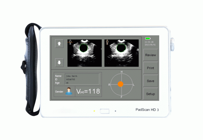 MDPro HD3 Bladder Scanner HD3 Bladder Scanner Units