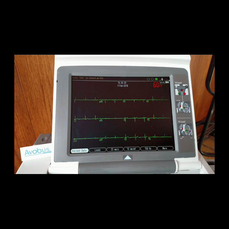 GE MAC 5500 EKG - Avobus Medical Equipment