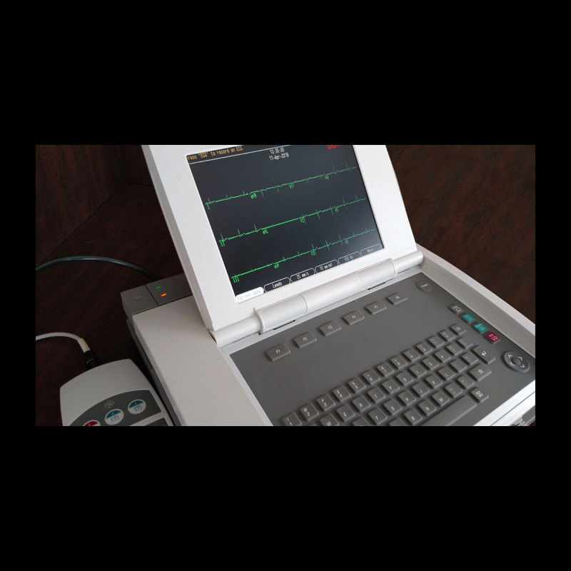 GE MAC 5000 EKG with CAM 14 Acquisition Module EKG Machine Units