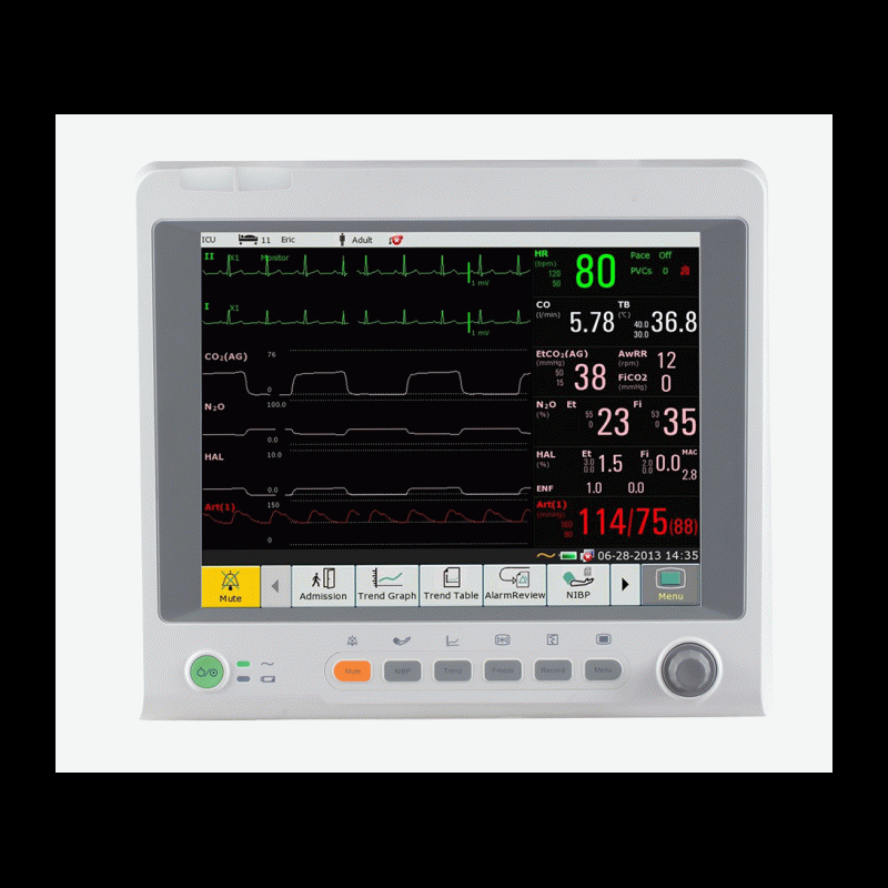 Edan iM70 Patient Monitor with 12 Lead ECG, SpO2, NIBP, Temp ...