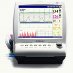 Edan F9 Express Fetal Monitor with Twins FHR, Toco, AFM, Fetal Movement ...
