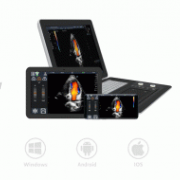 MDPro P50 Solo Scan Portable Ultrasound P50_Main Portable Ultrasound Units